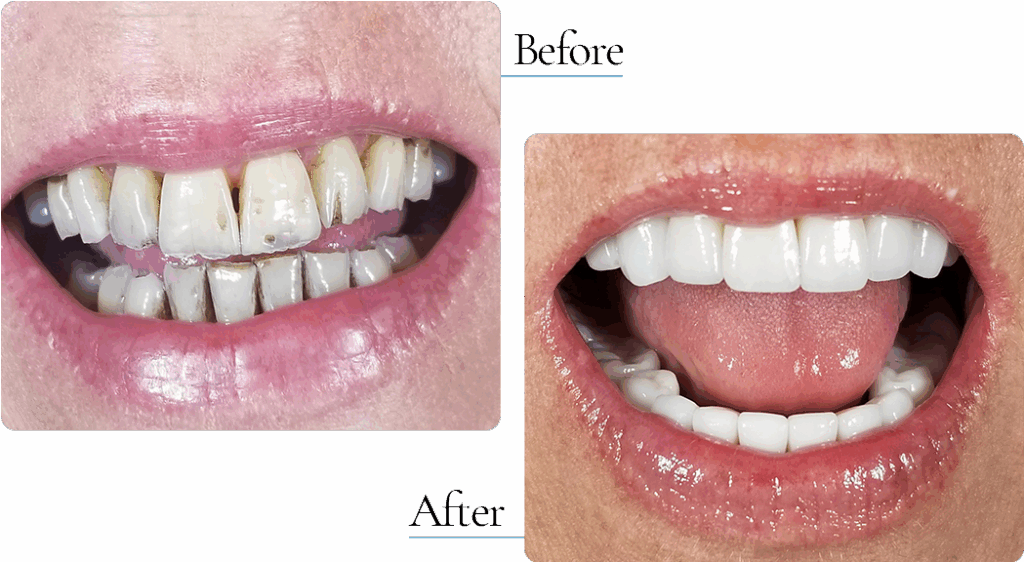 Smile Gallery - Artistic Family Dentistry - Gina R Davis DDS PA