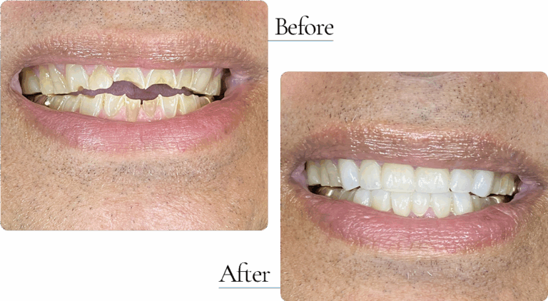 Smile Gallery - Artistic Family Dentistry - Gina R Davis DDS PA